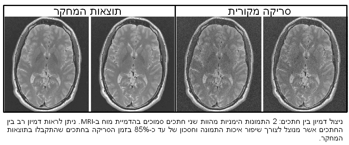 A silent MRI scan in a sixth of the time required today - the scientist ...