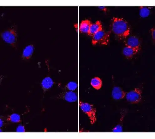 Surprising findings in diabetes research: beta cell aging increases ...