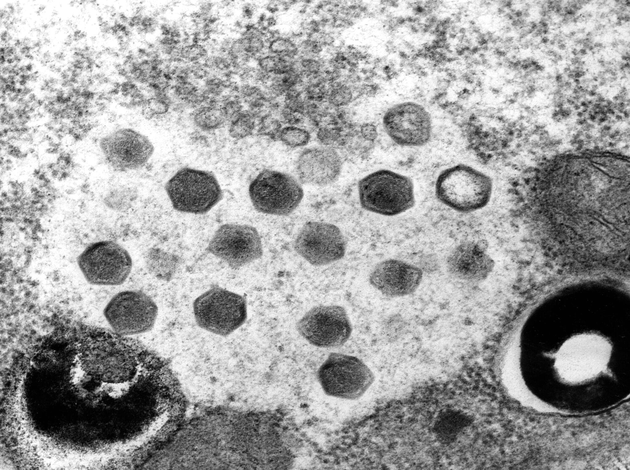 Unique light receptors shared by marine giant viruses and the algae ...