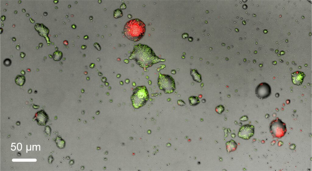 The environment dries up - on dust, leaves, bacteria and moisture - the ...