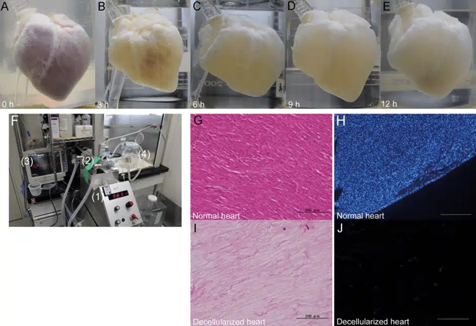 The present and future of the replacement organs of the body - the ...