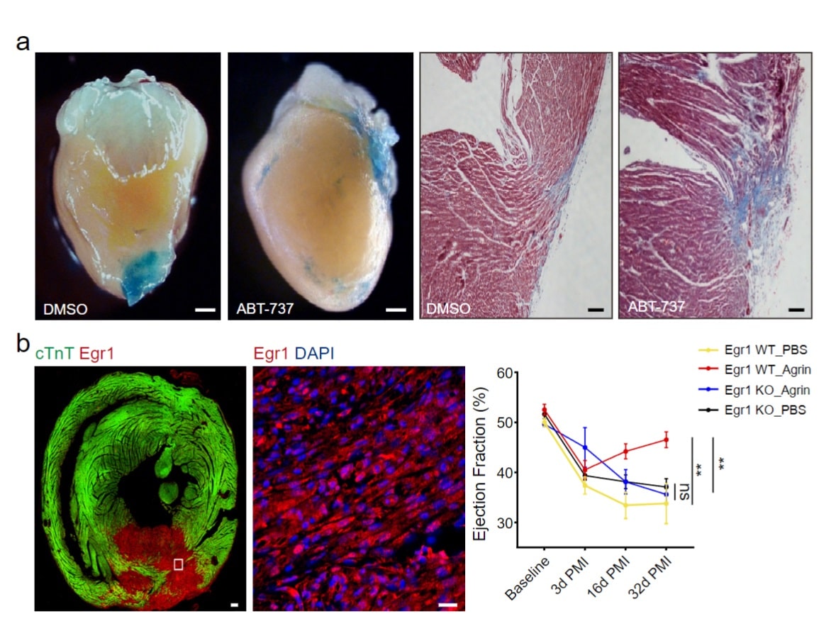 Researchers have discovered a mechanism of heart tissue regeneration ... Researchers have discovered a mechanism of heart tissue regeneration ...