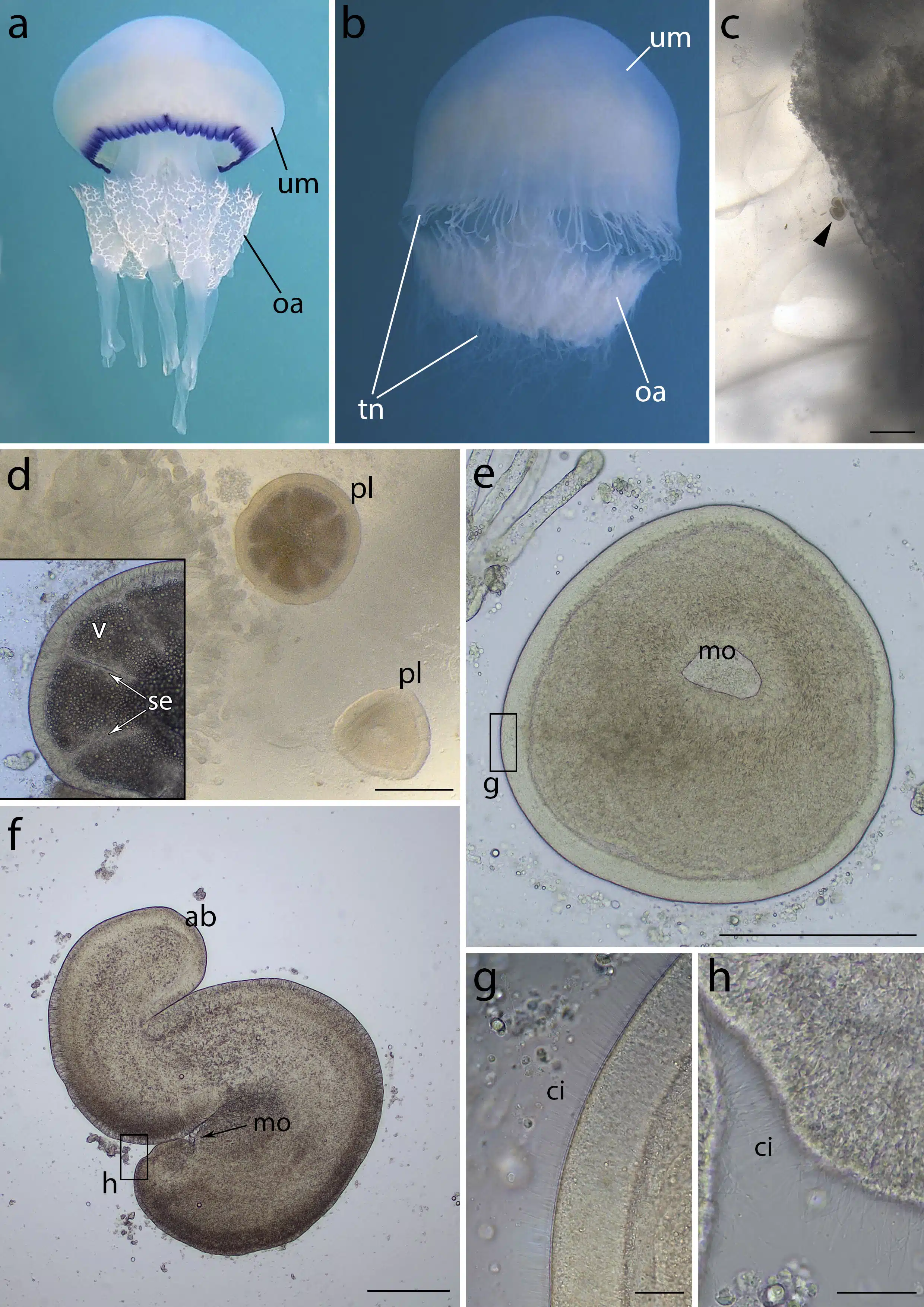 Jellyfish under attack: Researchers have found parasitic sea anemones ...